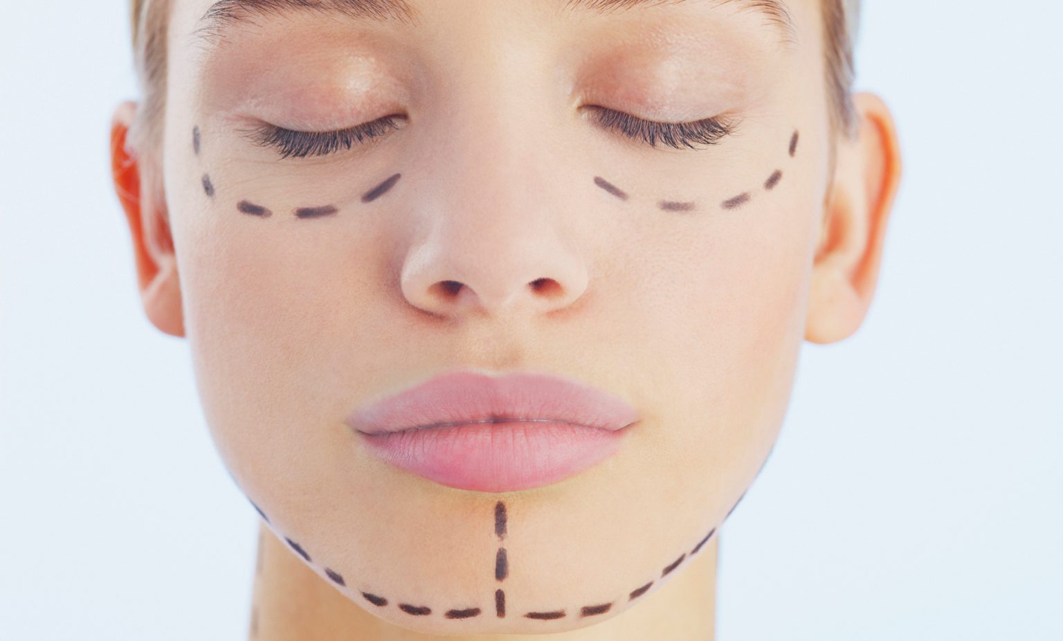 Gelaatscorrecties | Dr. Van Canneyt